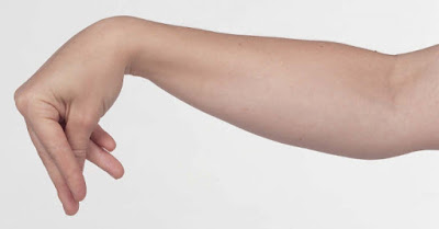 What is Carpopedal Spasm - Definition, Symptoms, Causes, Treatment ...