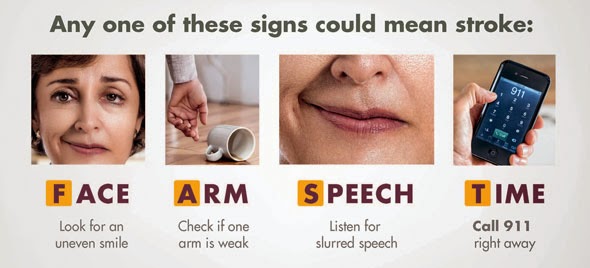 Emerson Villela Carvalho Jr., M.D.: Tips to Detect Early Warning Signs of Stroke