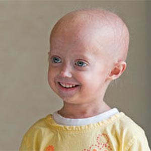 progeria pictures ~ Christine O'Donnell