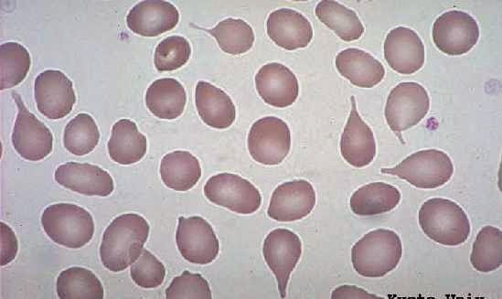 Atlas de Células Sanguíneas