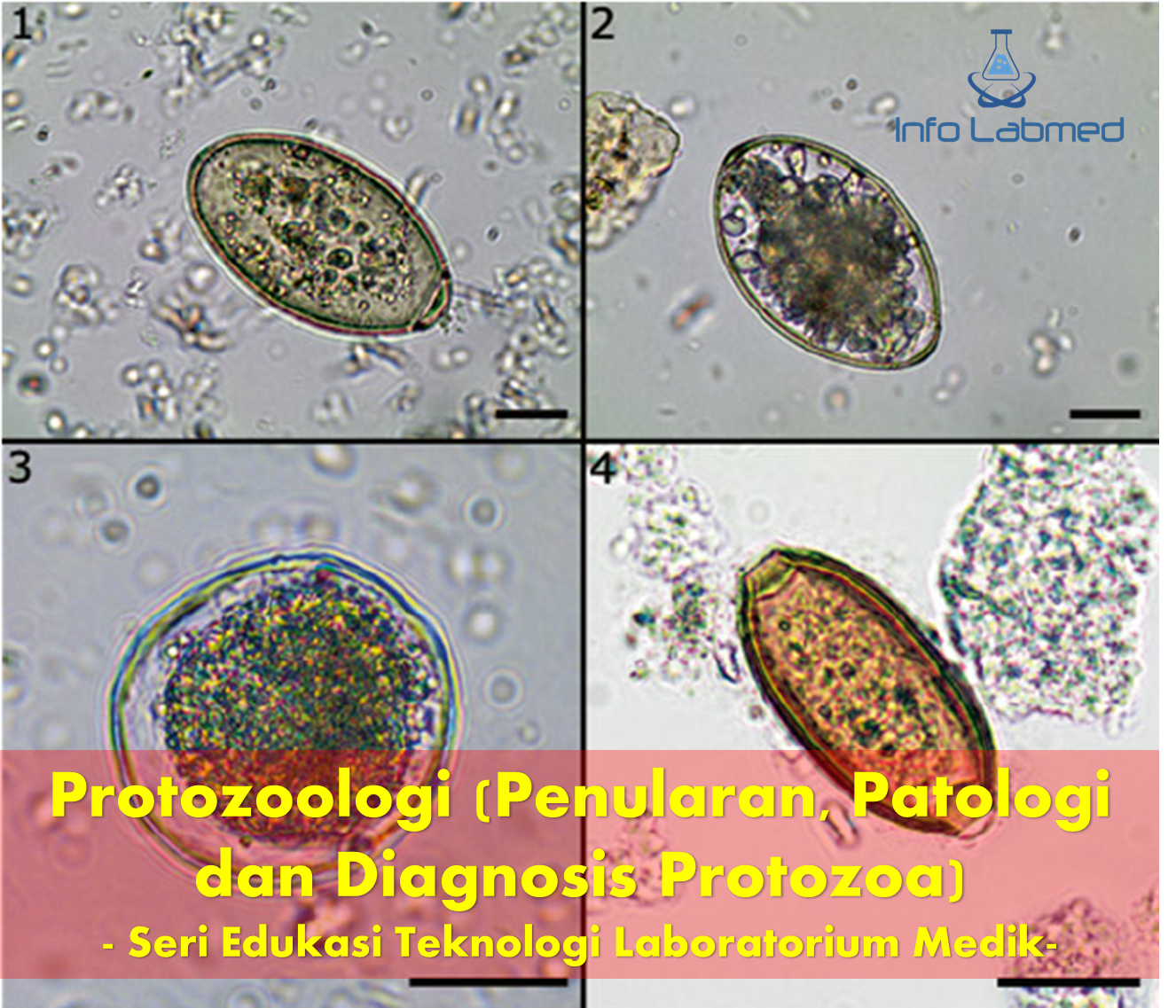 Protozoologi (Penularan, Patologi dan Diagnosis Protozoa) - Seri ...