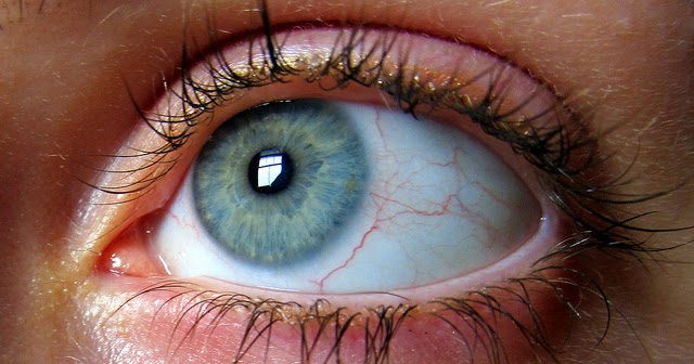 AAEM Resident and Student Association : Ocular Emergency: Retinal ...