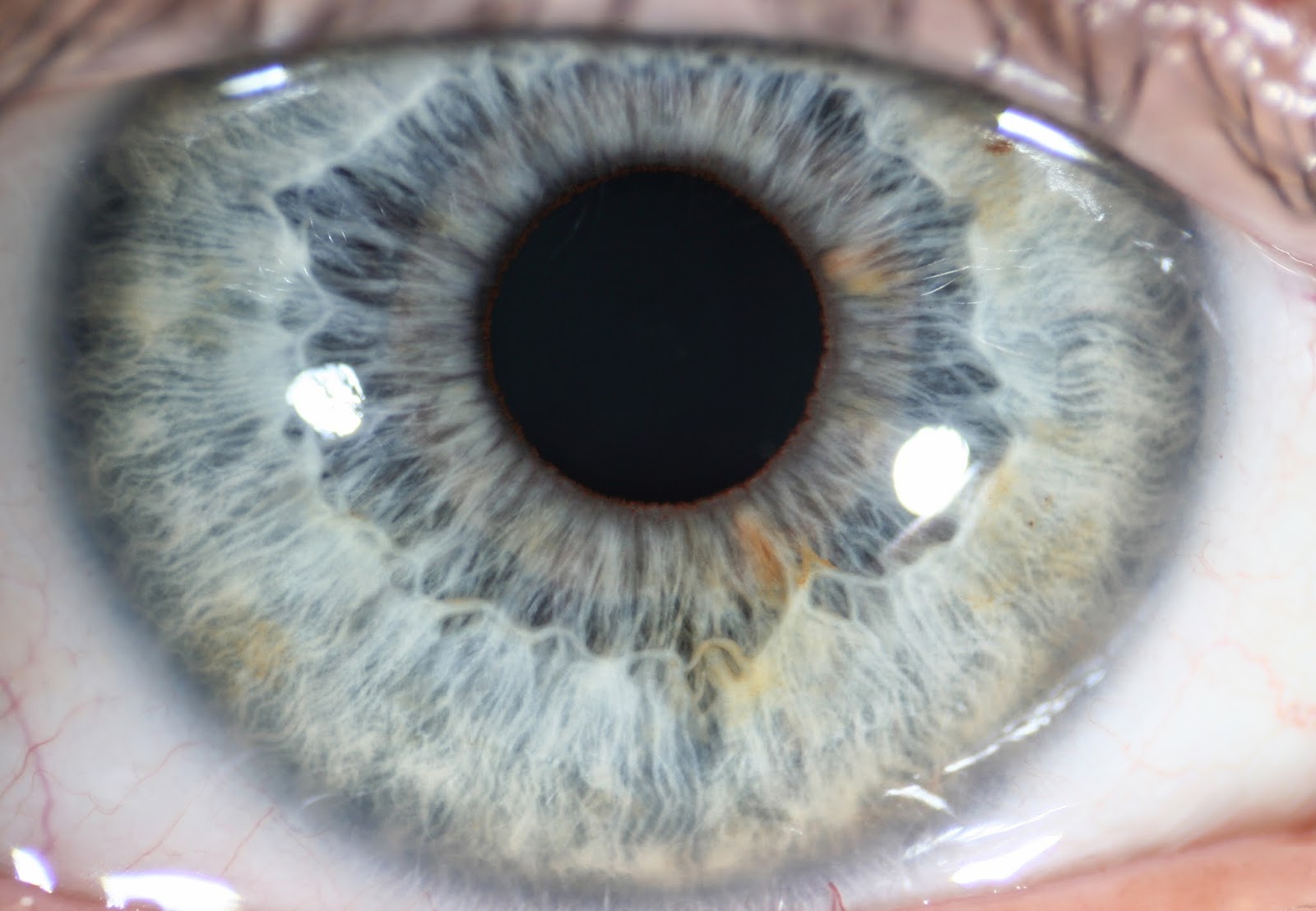 Modern & Multidimensional Iridology: June 2014