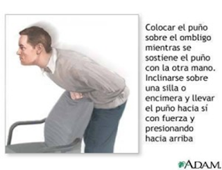 OVACE, QUE ES Y CÓMO SE REALIZA LA ATENCIÓN.