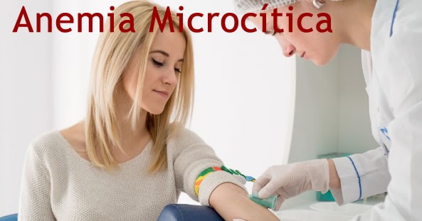 Anemia Microcítica ~ Laboratorio de Extraccionistas