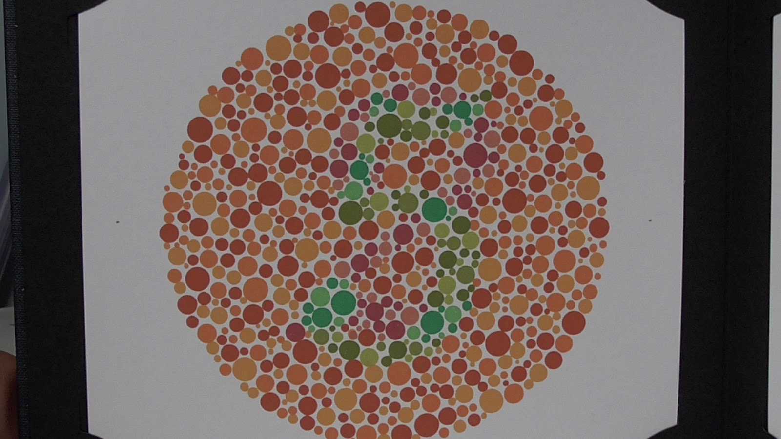 Symptoms, Causes and Treatment of Color Blindness - Just Call Me, Adi