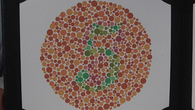 Symptoms, Causes and Treatment of Color Blindness - Just Call Me, Adi