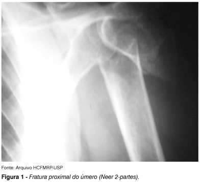 Blogão de Fisio: FRATURAS DO MEMBRO SUPERIOR