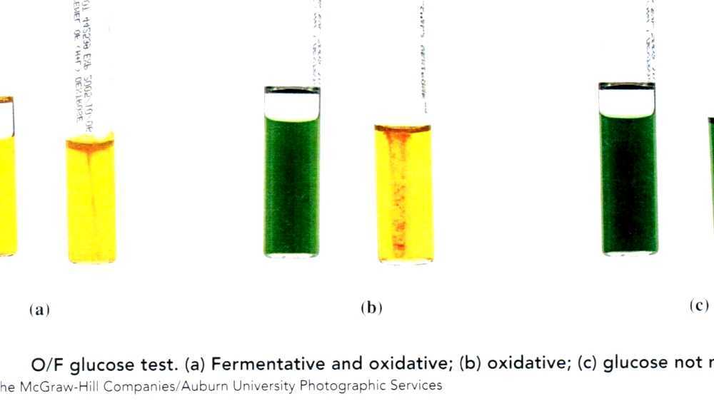 Oxidative/fermentation glucose test