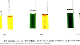 Oxidative/fermentation glucose test