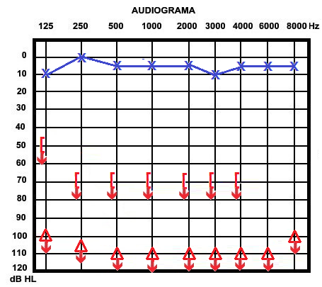 2014 ~ Audiología didáctica para estudiantes