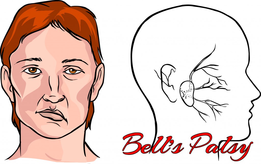 Cara Mengobati Ambeien / Wasir Yang Aman: Tanda Dan Gejala Penyakit ...