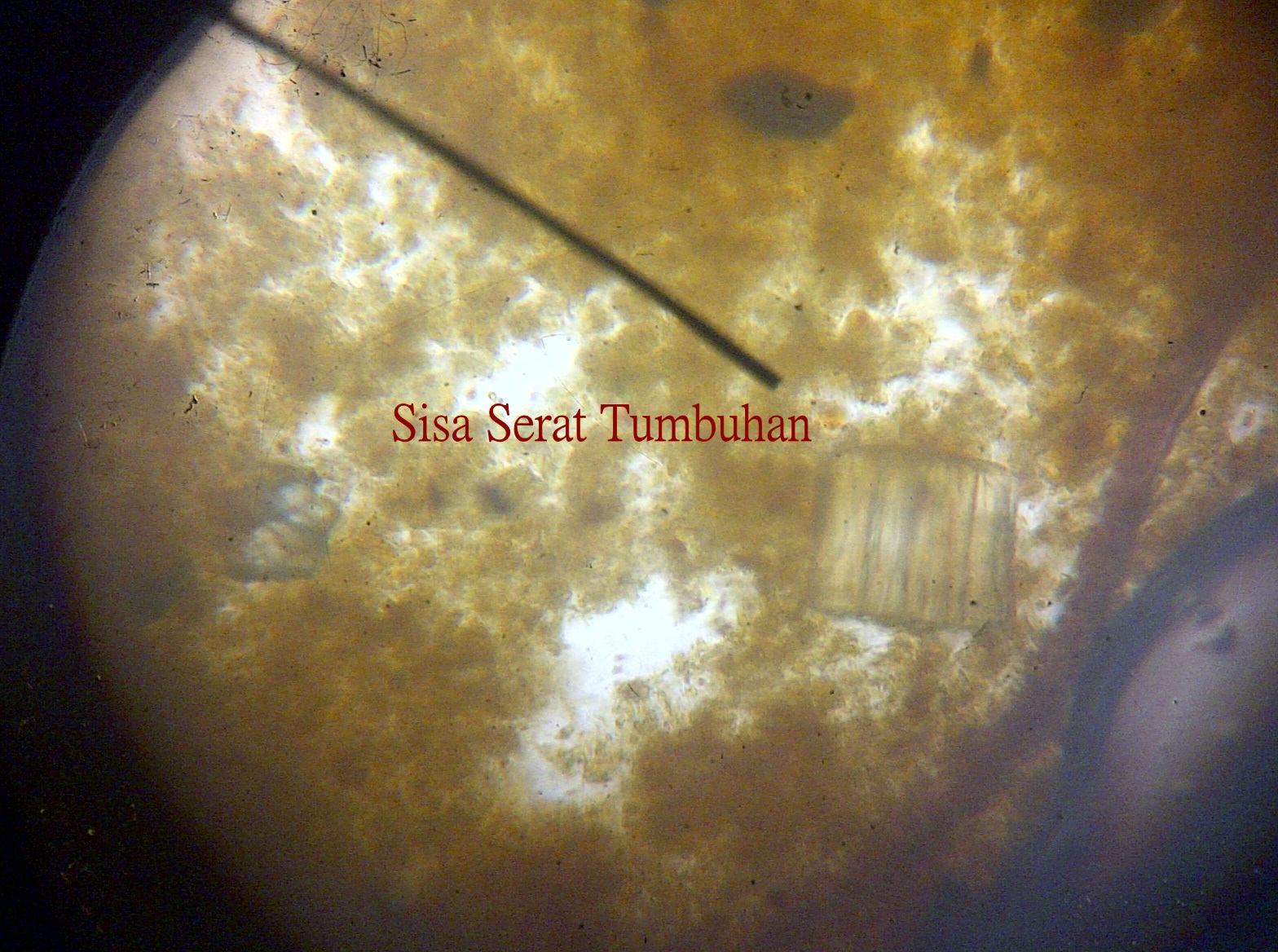 Rizqi Murtafi'ah: Pemeriksaan Feses Lengkap