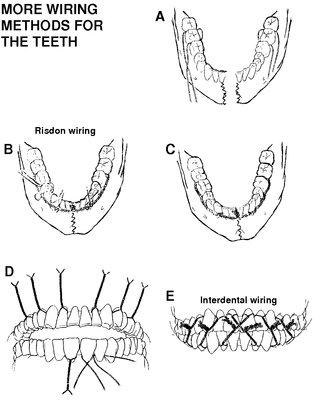 Masih Ada Plan B: Pengalaman patah rahang. Indah!