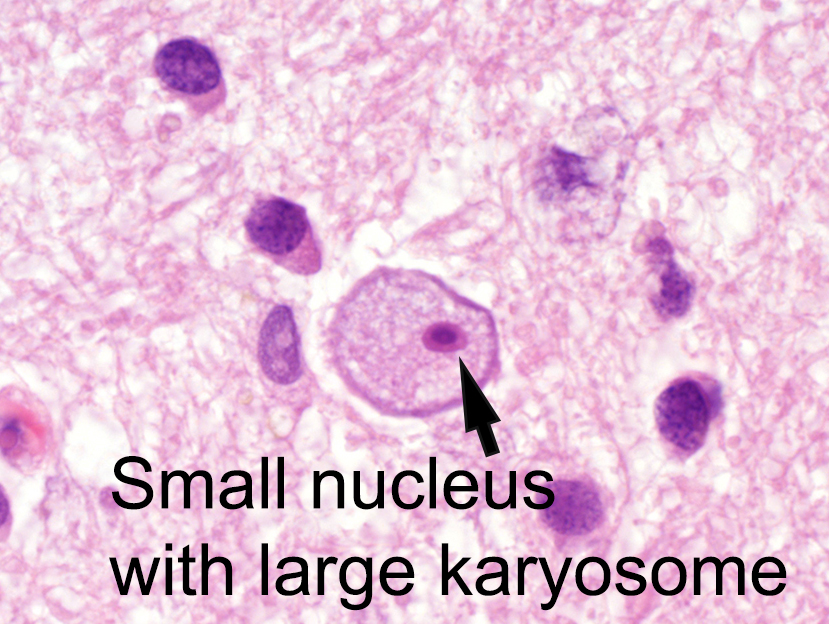 Creepy Dreadful Wonderful Parasites: Answer to Case 356