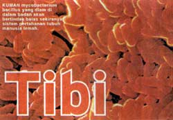 Nuh Mekin: TANDA DAN GEJALA PENYAKIT TIBI PARU-PARU