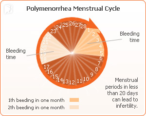 DEDICATED TO ALL WOMEN OF THE WORLD: Polymenorrhea or Frequent Periods