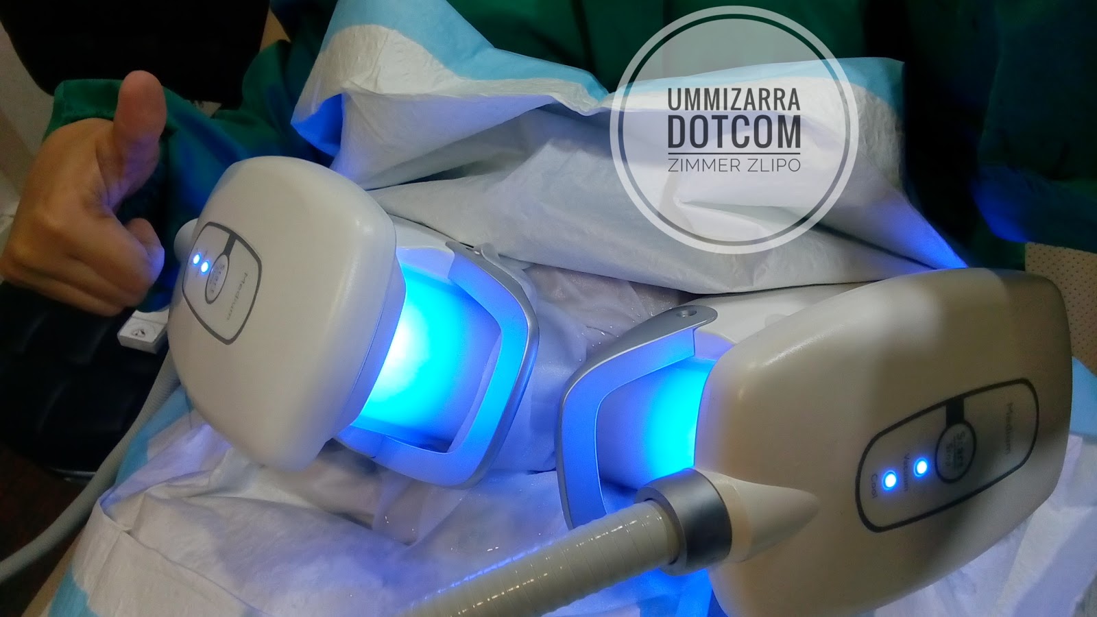 BUANG LEMAK TANPA RASA SAKIT DENGAN ZIMMER Z LIPO DAN Z WAVE