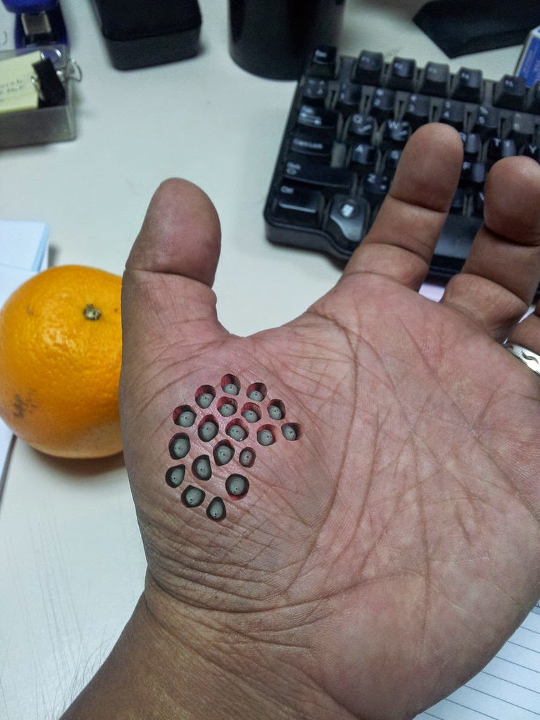 Trypophobia, the Lotus Seed Pod Phobia - Philippines Viral News