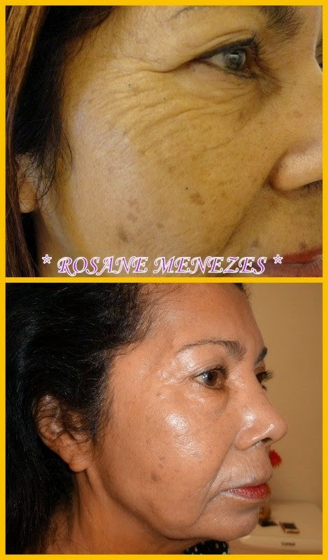 Rosane Menezes, Saúde e beleza.