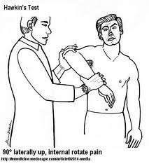 Move to Improve: Are You Training Yourself To a Shoulder Injury?