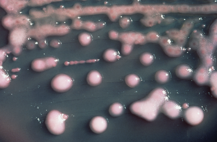 Klebsiella Pneumonia - Scilintia