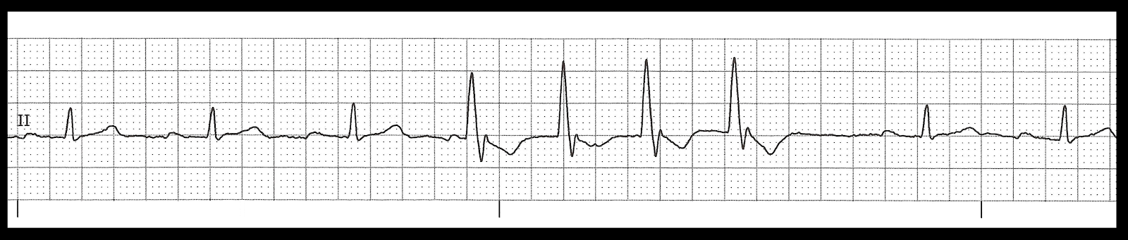 Practice EKG Strips 390