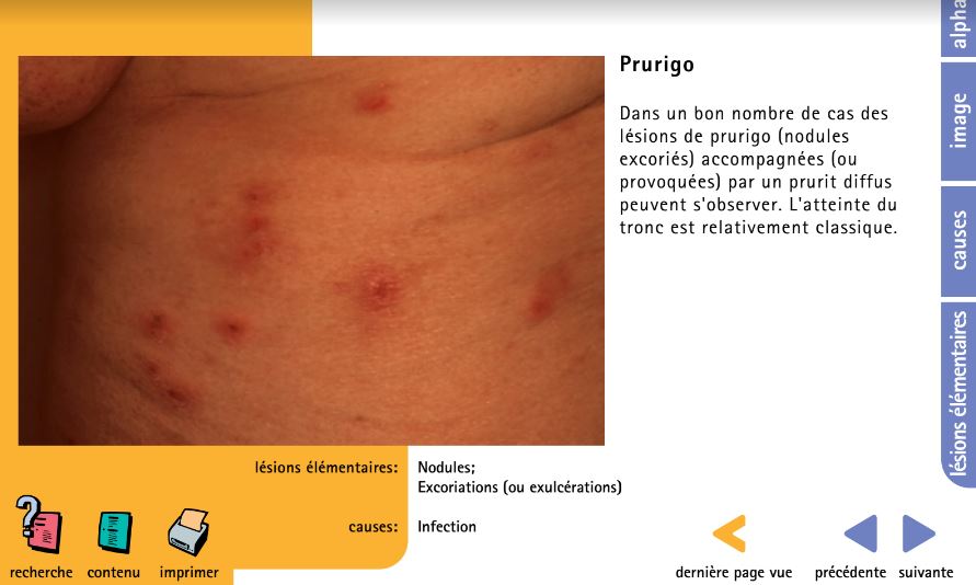 lesion elementaire en dermatologie pdf