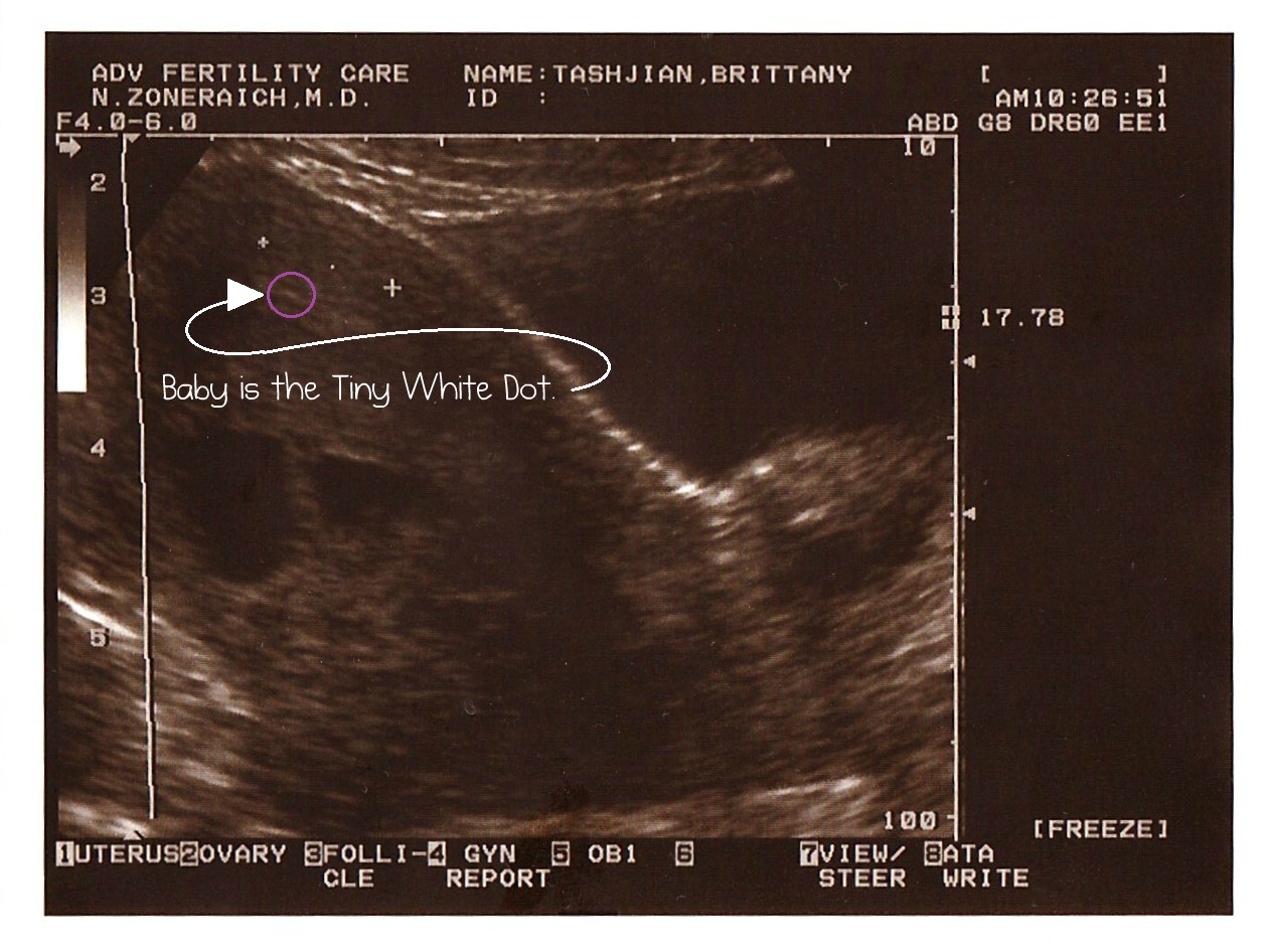 Ovulation Success: My Little Fighter Embryo