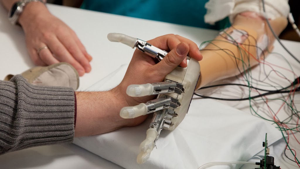 Bionic hand allows human to "feel” real size, texture and shape of ...