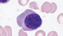 Polychromatophilic Normoblast ~ Hematology Lectures