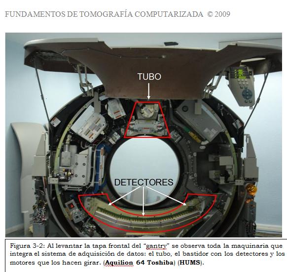 El Baúl Radiológico: MECANISMO FÍSICO DE ADQUISICIÓN DE DATOS EN ...