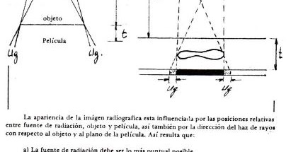 INSTRUMENTACIÓN Y EQUIPOS EN DIAGNÓSTICO POR IMÁGENES: LA PROYECCIÓN ...