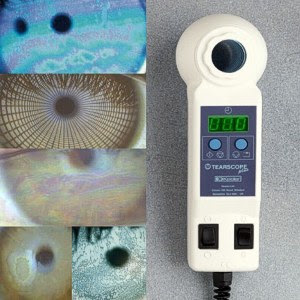 Tearscope