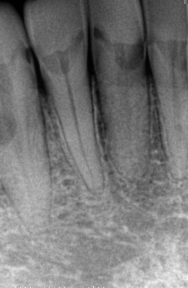 DrChetDMD: Rampant Decay