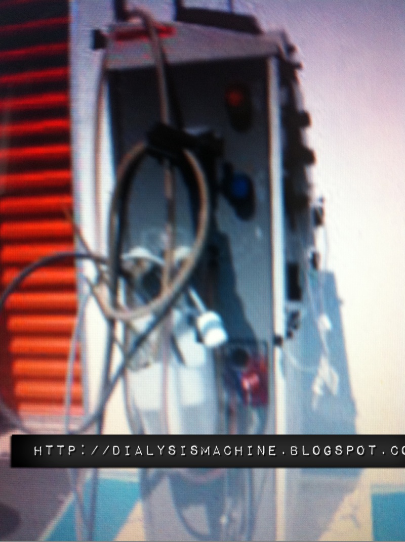 Dialysis Machine