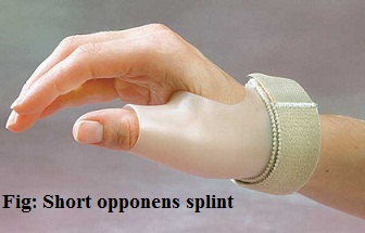 Short opponens splint