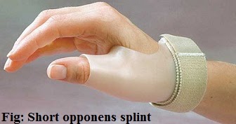 Short opponens splint