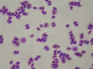 Alteración de los Eritrocitos : Alteraciones por Color