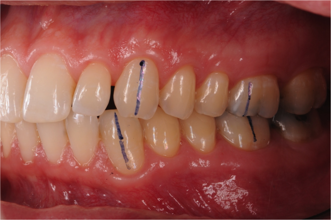 Dental Photography Pearls For Better Images Instantly