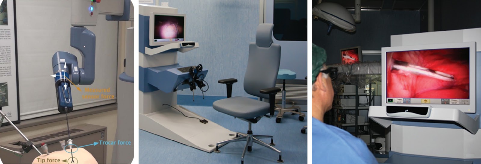 Updates on the ALF-X system