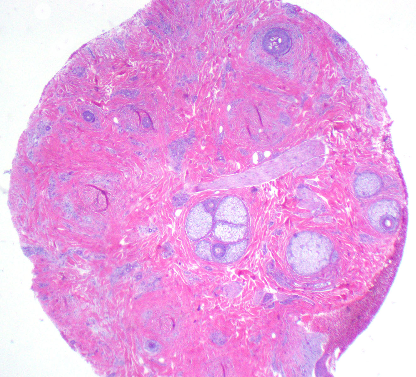 VIRTUAL GRAND ROUNDS IN DERMATOLOGY 2.0: Central Centrifugal ...
