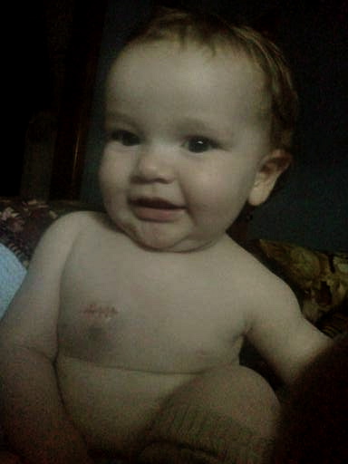 Bubble Wrapped Birth: SCAR