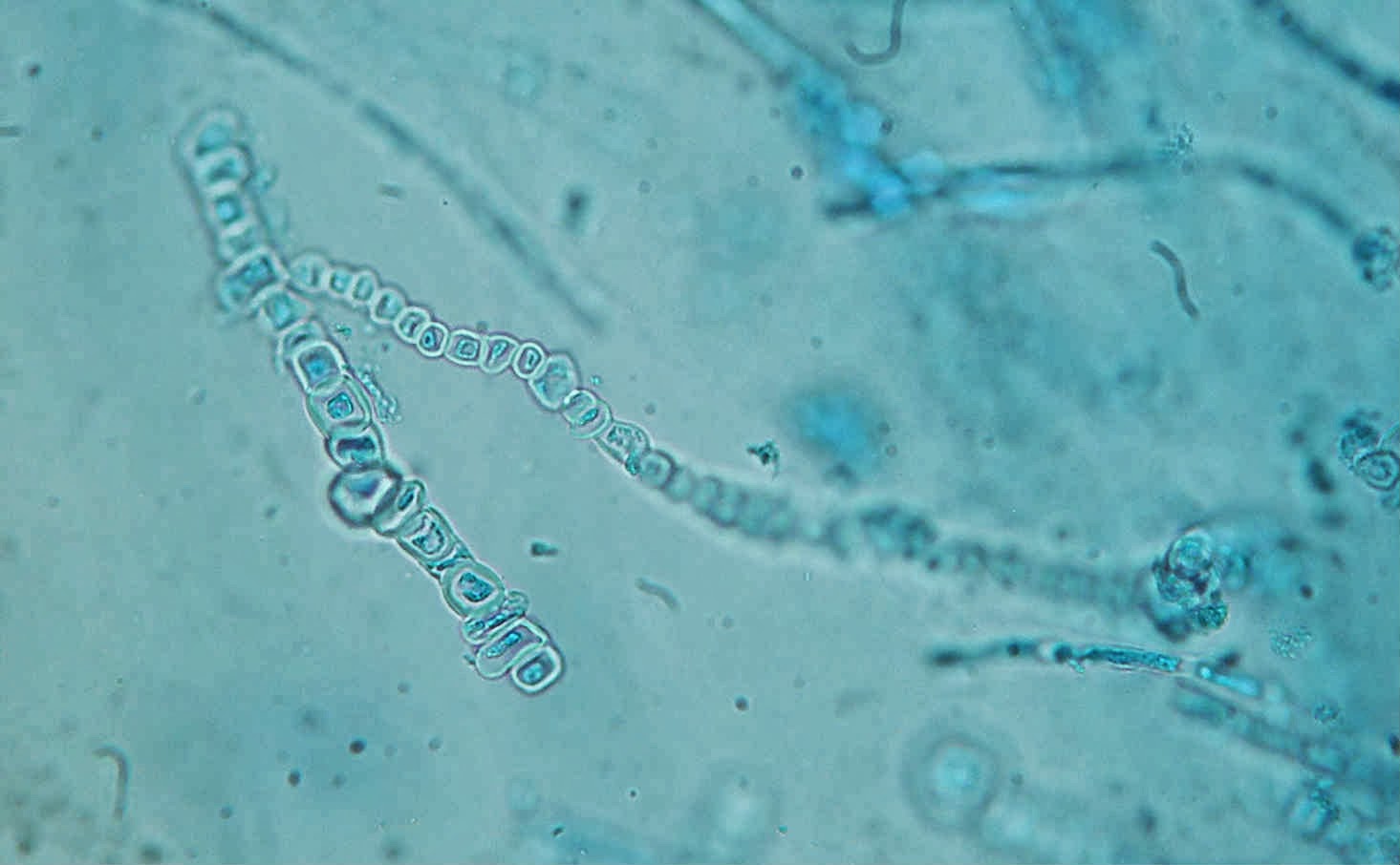 ATLAS MICOLOGIA: TRICHOPHYTON VERRUCOSUM