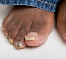 Feet repair for Men with bad feet : 5 Steps To Easy Fix for "Men With ...