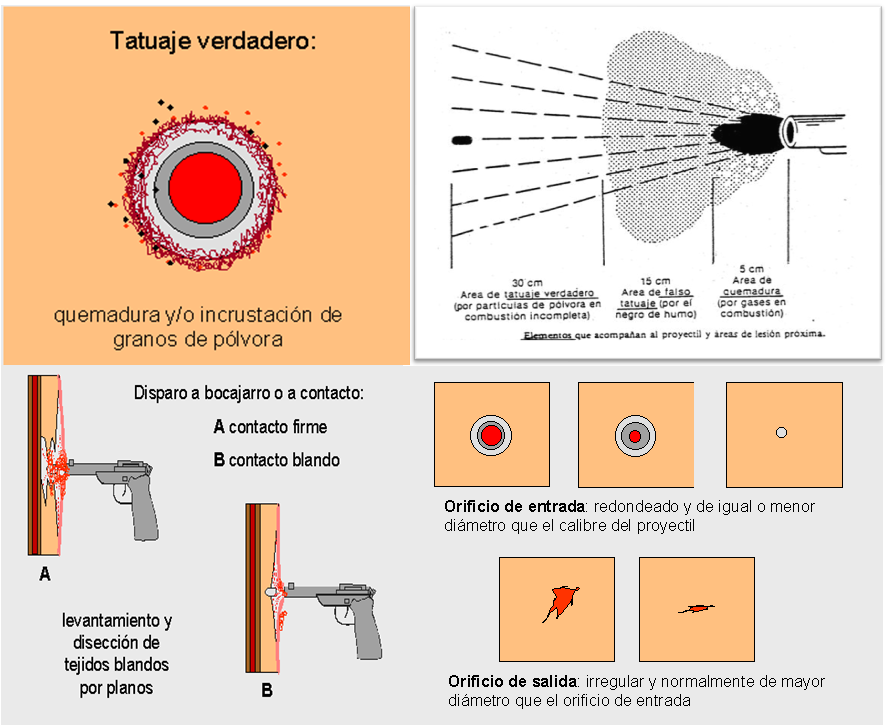 BALÍSTICA FORENSE