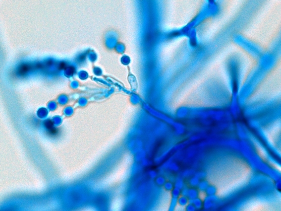 Fun With Microbiology (What's Buggin' You?): Aspergillus versicolor