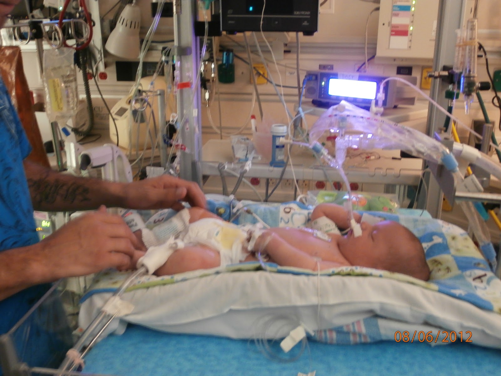 Our Journey: Birth- NICU- Tube Feeding