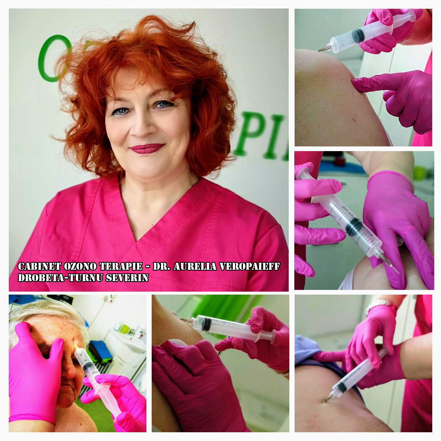 Oxigen-Ozonoterapie: Infiltratii subcutanate cu ozon