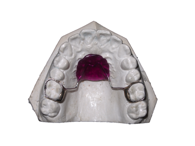 Open Lab UPC Ortodoncia 2012 : BOTON DE NANCE